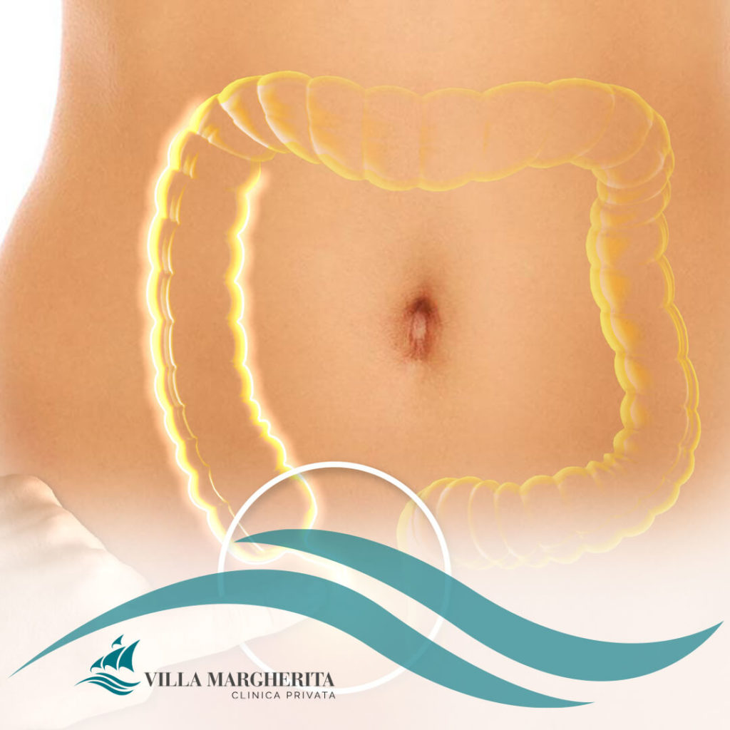 Occlusione intestinale: sintomi, cosa fare e cure possibili